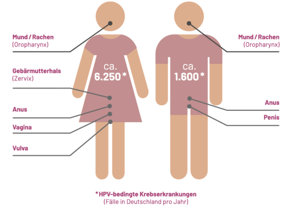 Hpv Frau Symptome